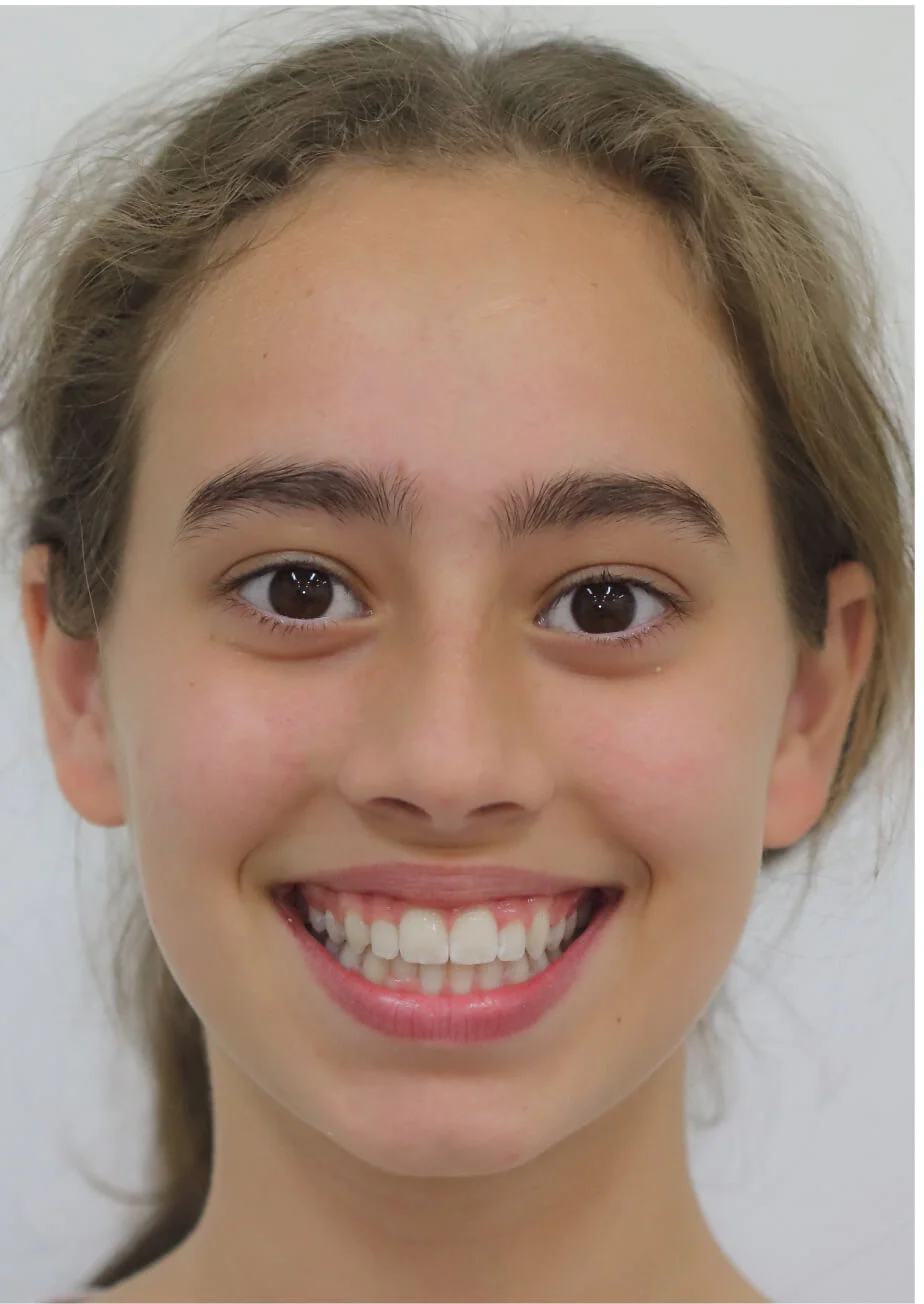 Bespoke Smiles Gallery